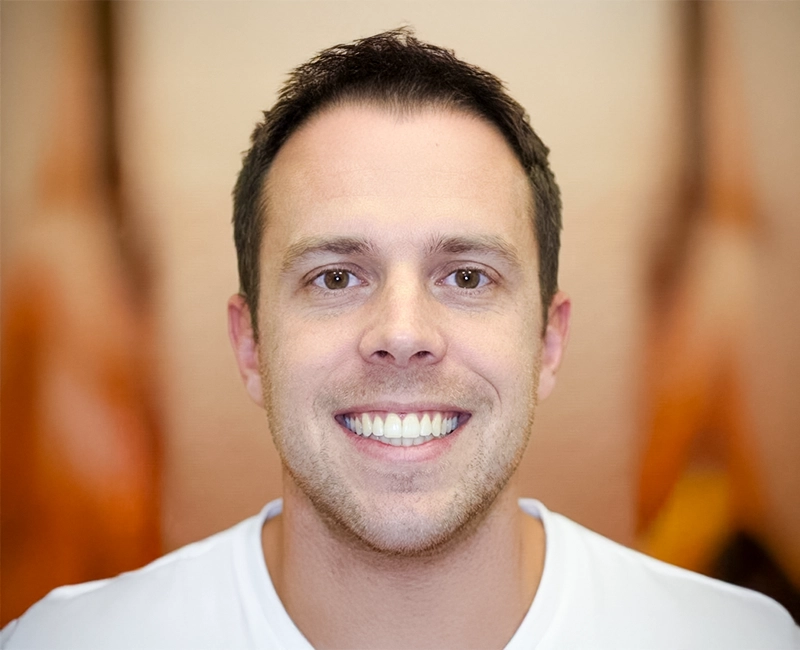 Case Study: Severe Crowding Treated with Invisalign - Showground Dental